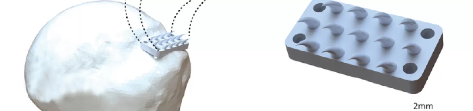 New Device Inspired by Python Teeth Doubles Strength of Rotator Cuff