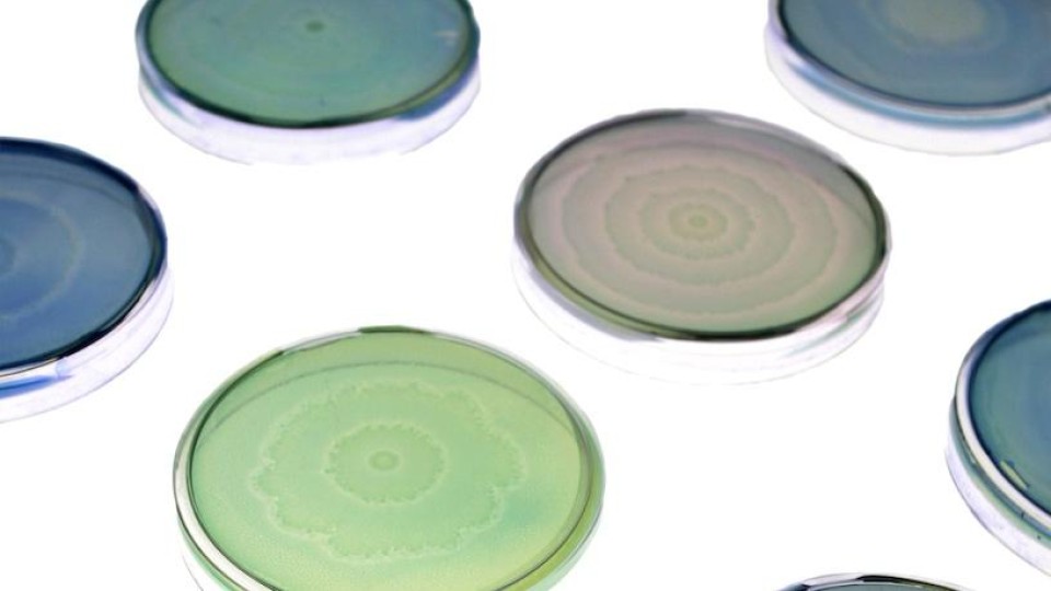 swarming proteus spp